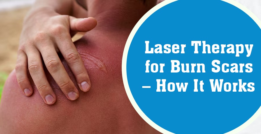 Laser Therapy for Burn Scars – How It Works